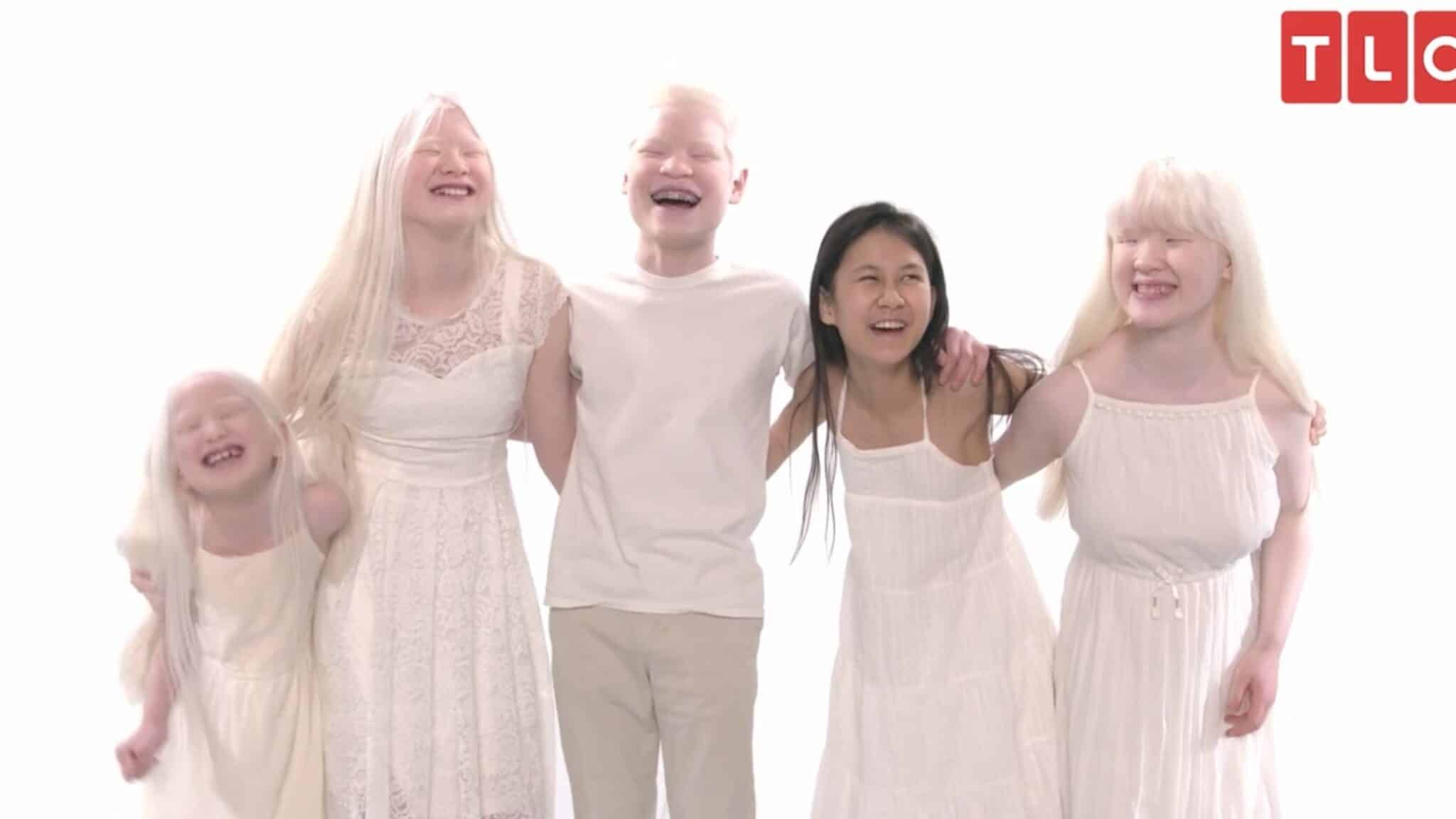 BORN WITH ALBINISM Jon and Liz Grabowski adopted five children from ...