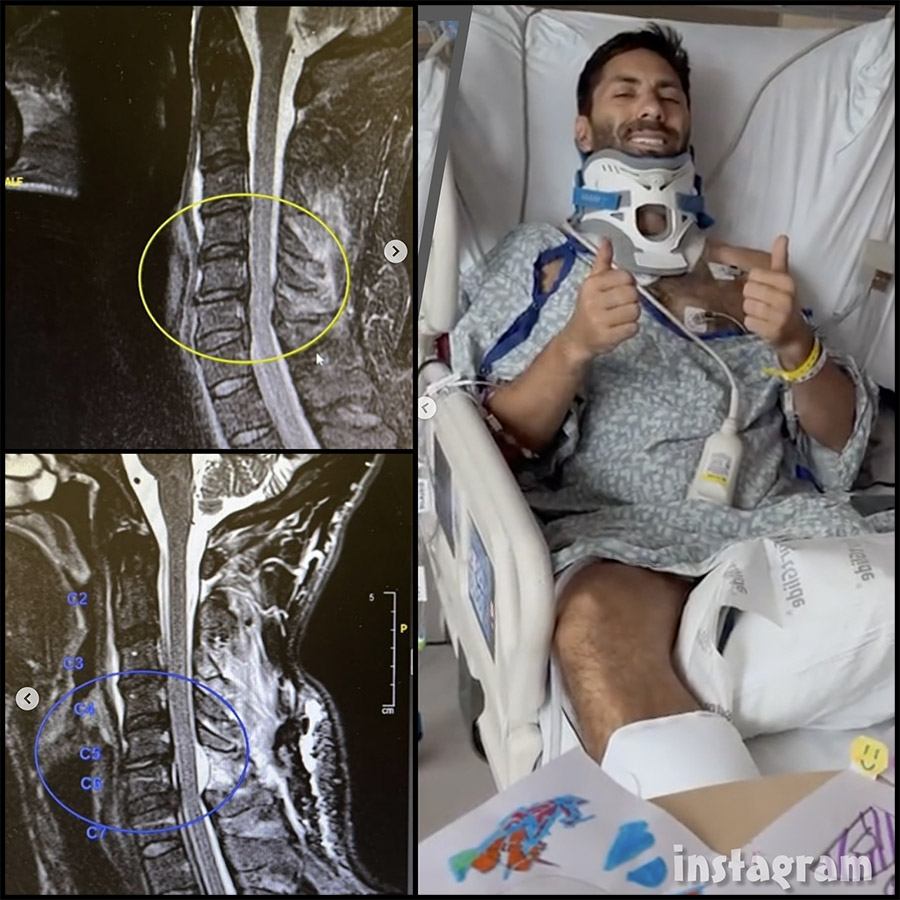 CATFISH Nev Schulman hit by truck while cycling, neck broken in 2 ...