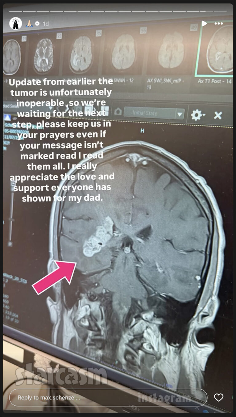 UNEXPECTED Max Schenzel’s dad Todd in ICU after stoke, diagnosed with ...